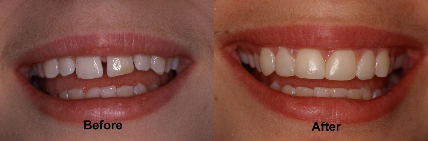 Gallery - Blue Collar Dental | Affordable, Honest, Quality Care